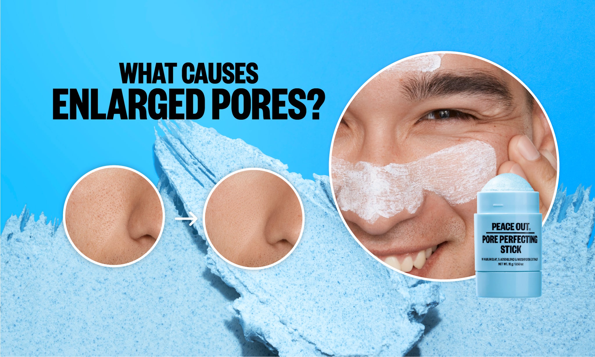 What Causes Enlarged Pores & How to Treat Them | Peace Out Skincare