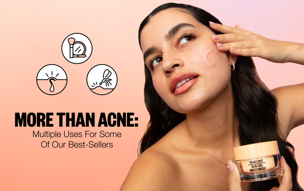More Than Acne: Multiple Uses for Our Best-Selling Products | Peace Out ...