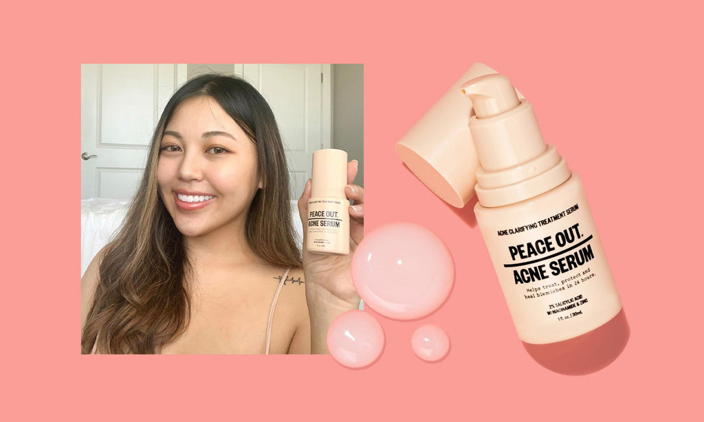 Skin Champs: SAVE MY SKIN with @HeyItsFeiii | Peace Out Skincare