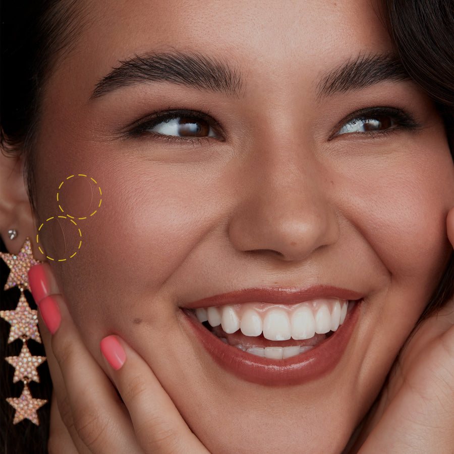 Acne Day Dots - Makeup-Approved - 20 Pack | Peace Out Skincare