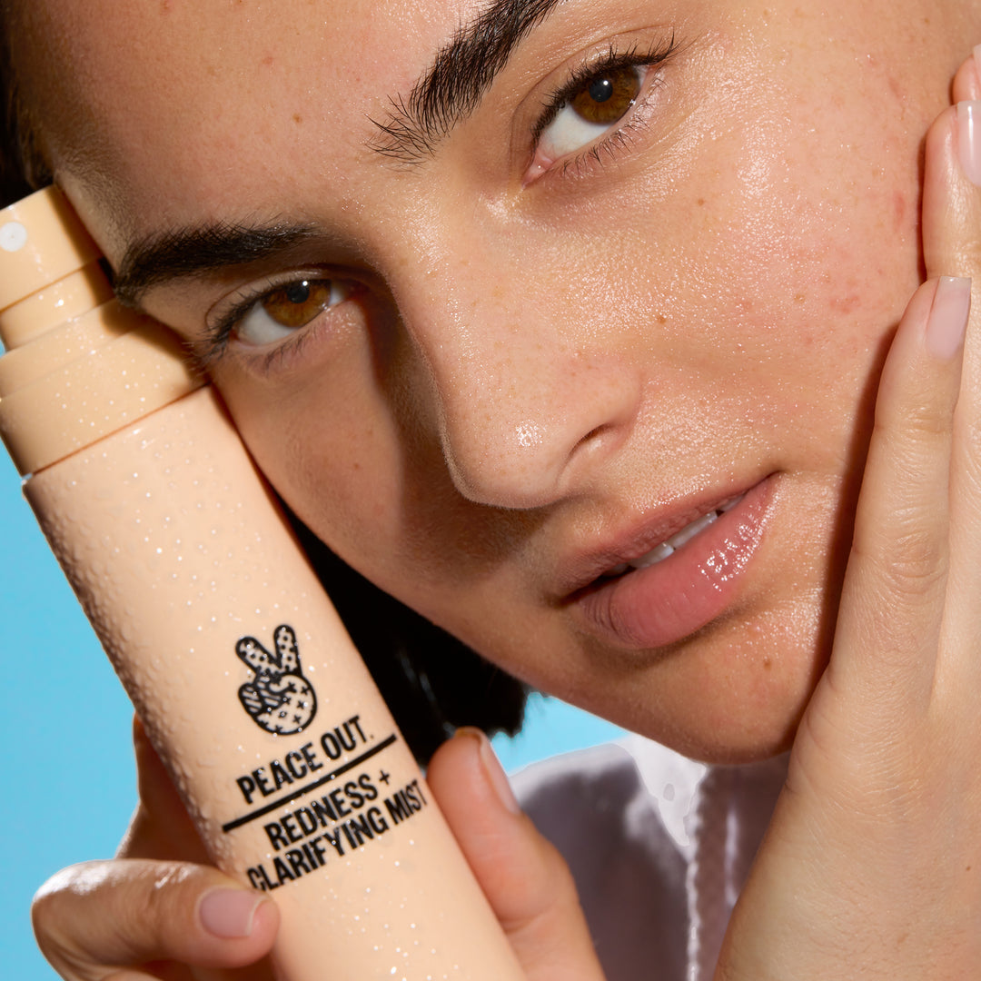 Soothing Mist for Angry, Acne Prone & Oily Skin | Peace Out Skincare
